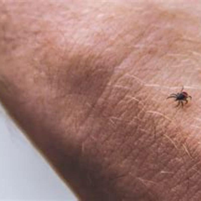 How Long Does Scabies Last On Cats Diy Seattle